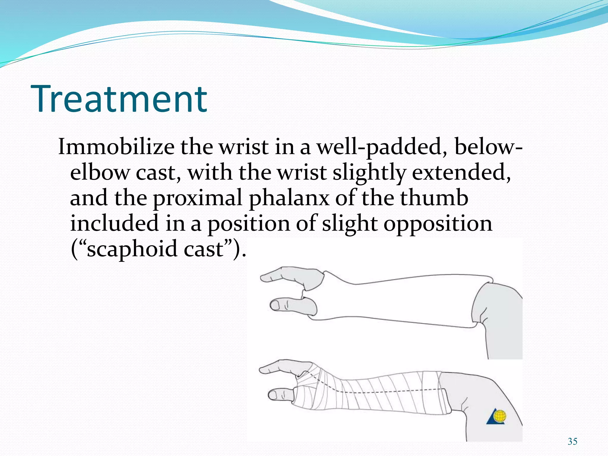 Scaphoid fractures | PPTX