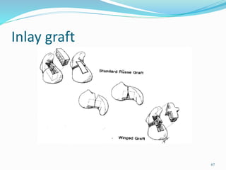 Scaphoid fractures | PPTX