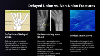 Scaphoid Fracture overview - Understanding and treatment | PPT
