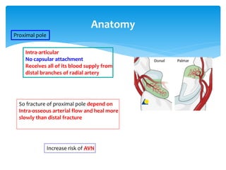 Scaphoid Fracture-RS.wjebndvuieboviewpdf | PDF