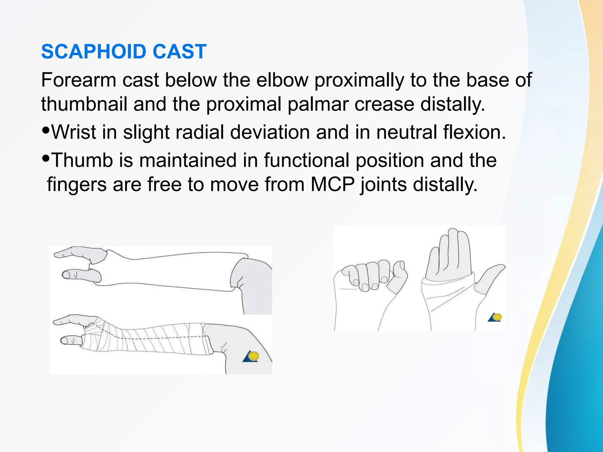 scaphoid FRACTURE(1).pptxccccccccccccccc | PPTX