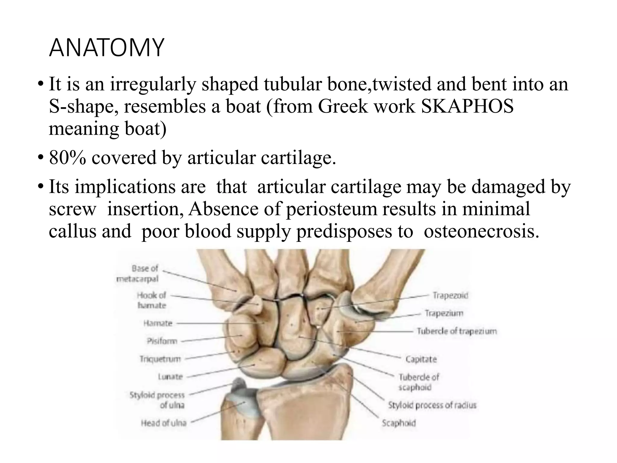 Scaphoid fracture and non union | PPTX