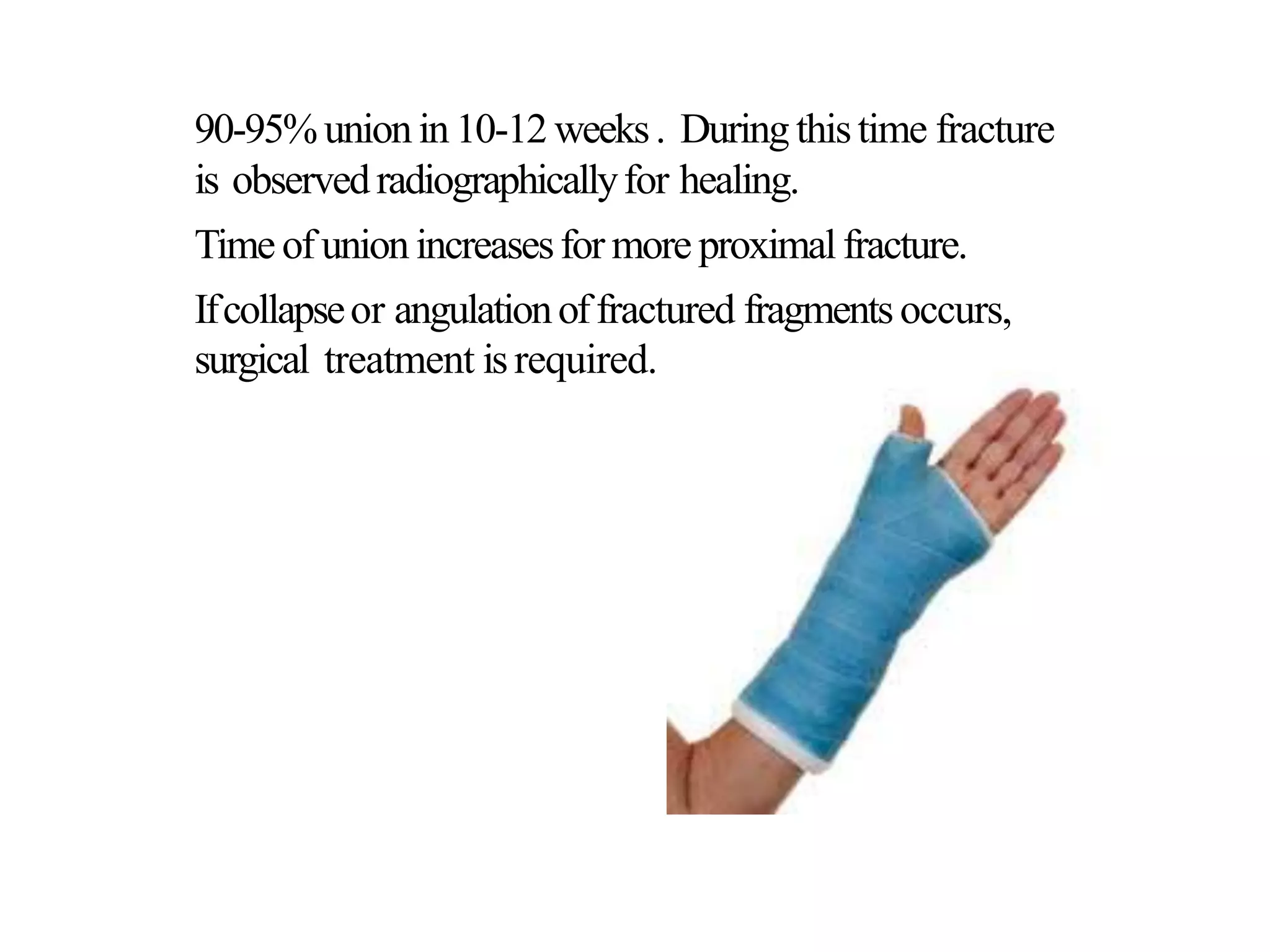 Scaphoid fracture and non union | PPTX