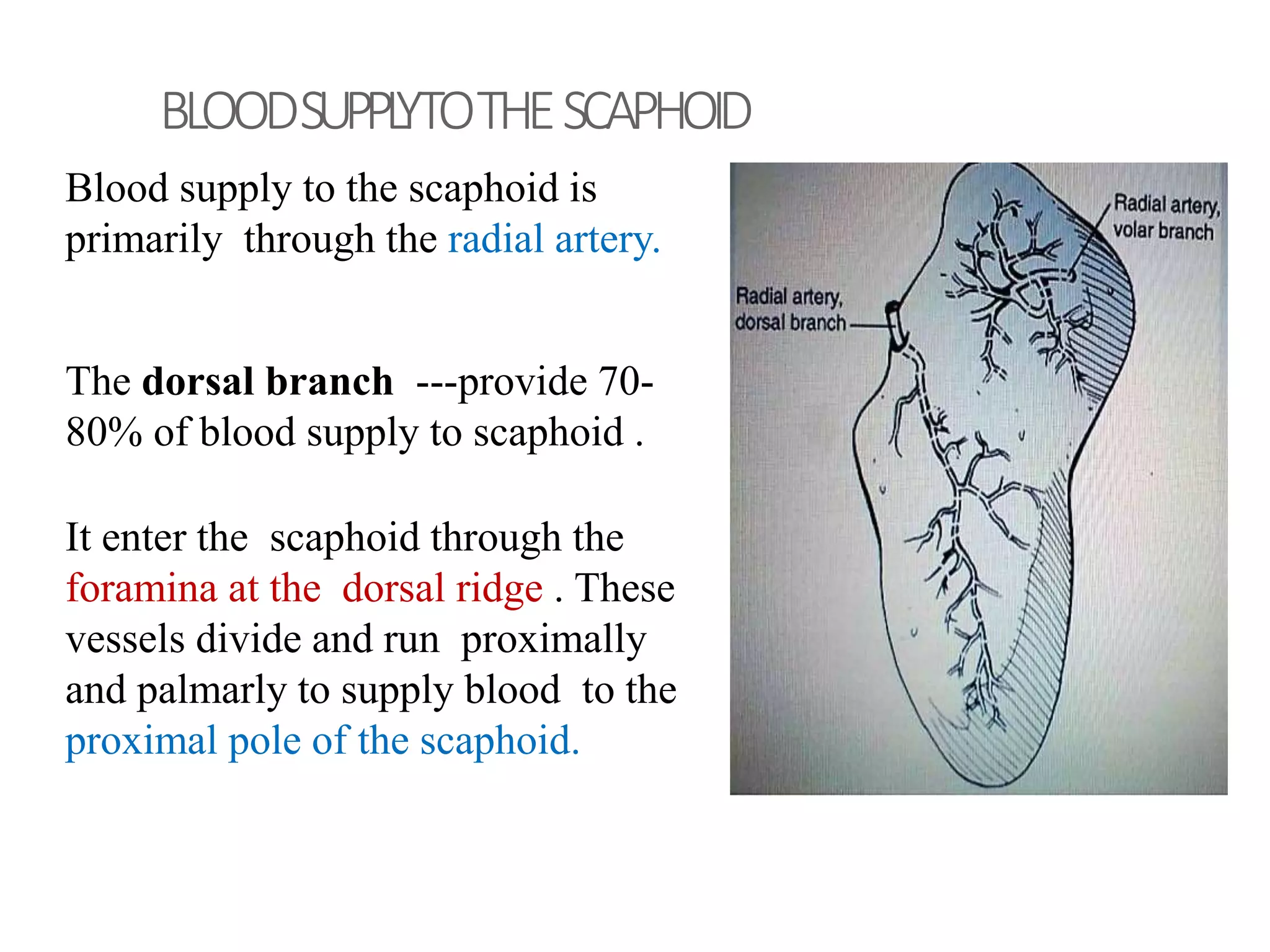 Scaphoid fracture and non union | PPTX
