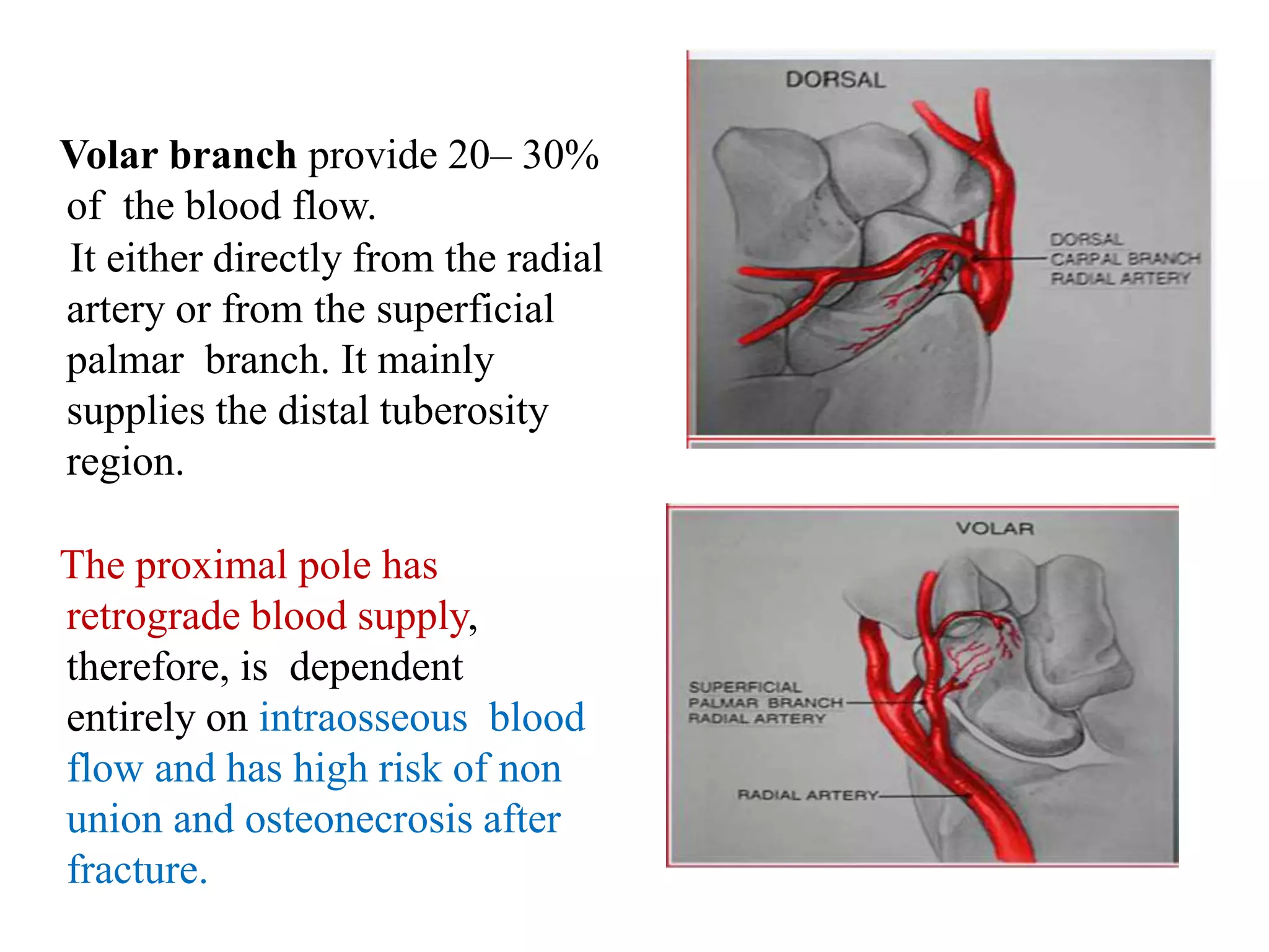 Scaphoid fracture and non union | PPTX
