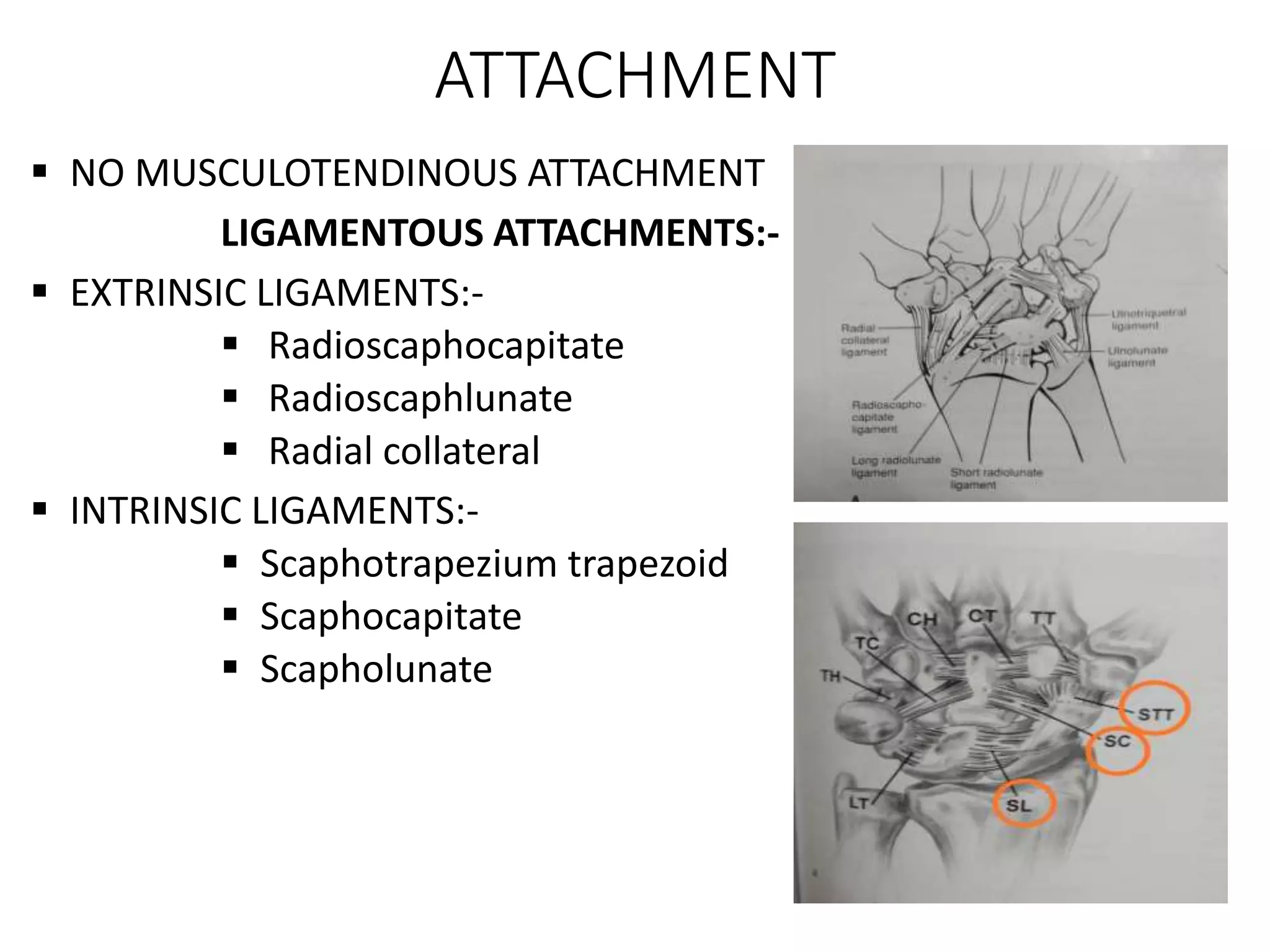 Scaphoid fracture and non union | PPTX