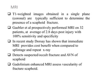 Scaphoid fracture and non union | PPTX