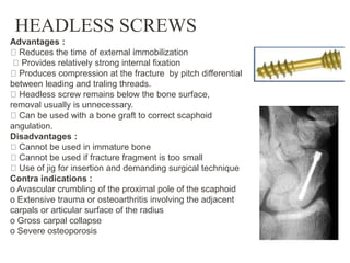 Scaphoid fracture and non union | PPTX