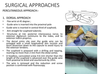Scaphoid fracture and non union | PPTX