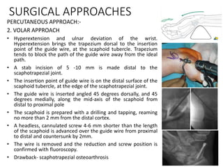 Scaphoid fracture and non union | PPTX