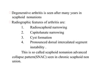 Scaphoid fracture and non union | PPTX