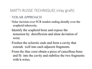 Scaphoid fracture and non union | PPTX