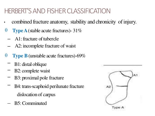 Scaphoid fracture and non union