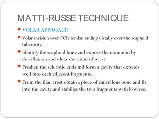 Scaphoid fracture and nonunion | PPT