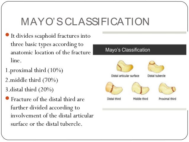 Scaphoid fracture and nonunion