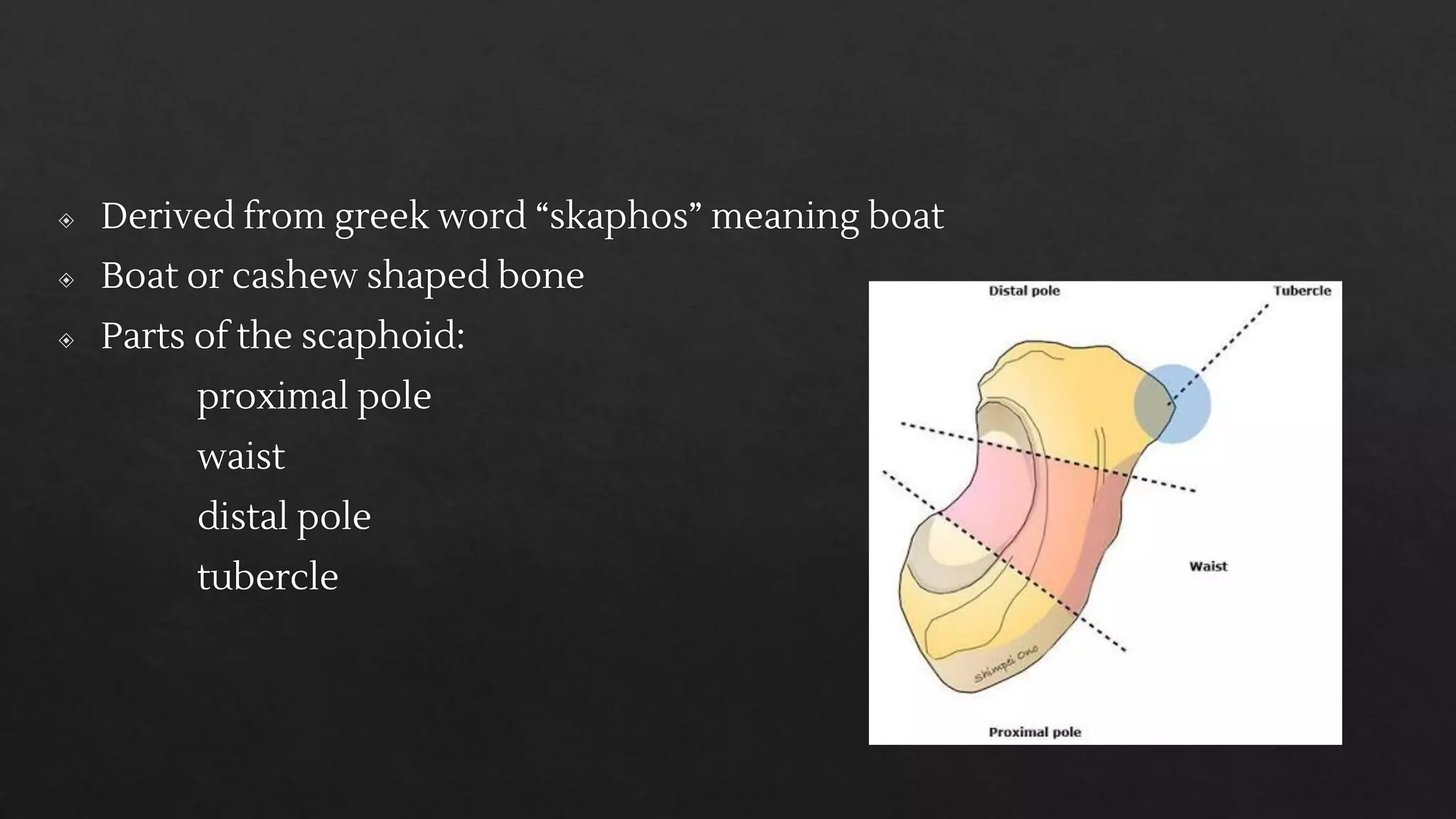Scaphoid fracture and perilunate dislocation | PDF