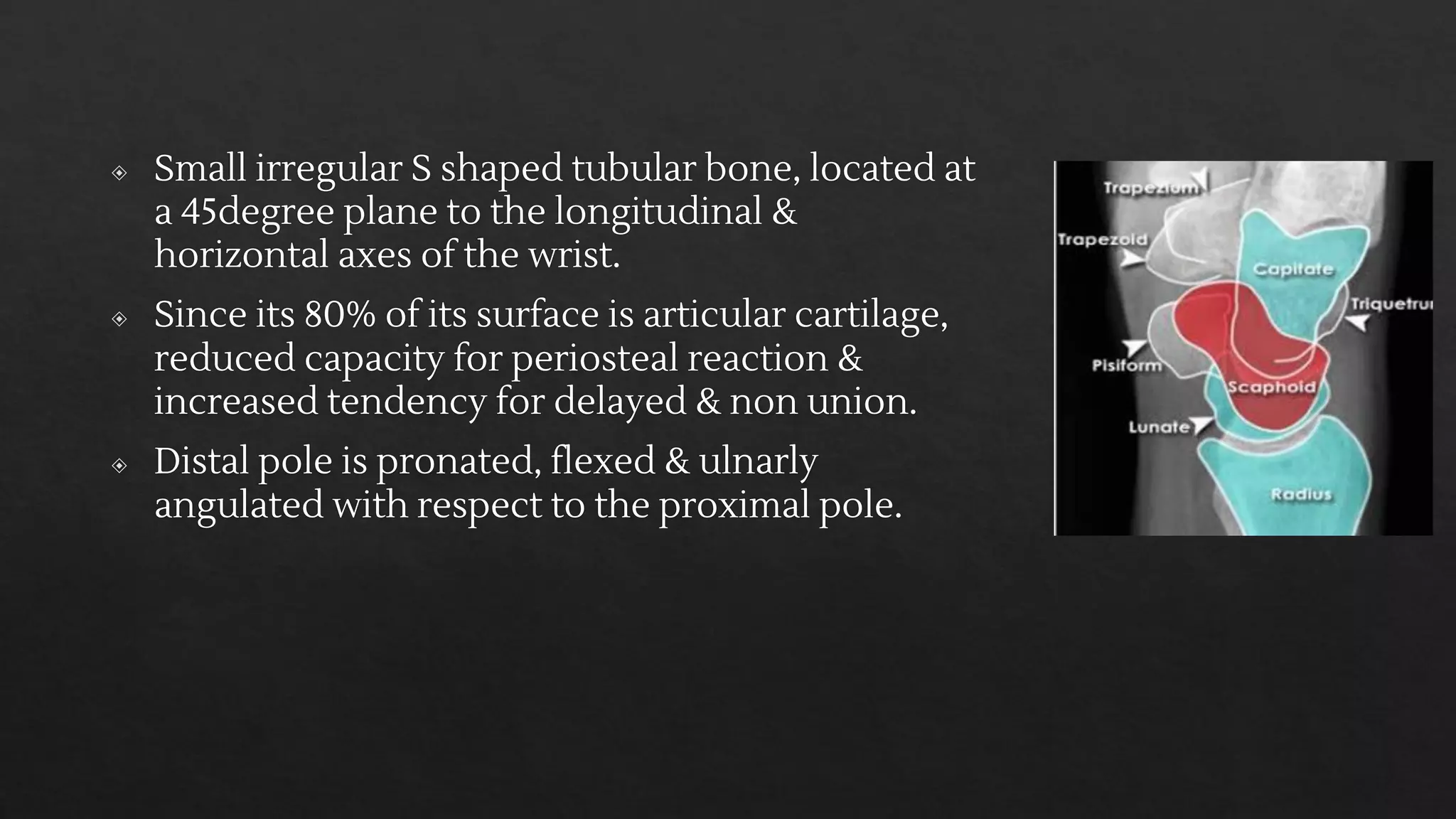 Scaphoid fracture and perilunate dislocation | PDF