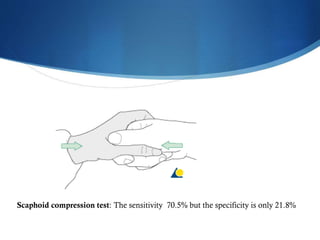 Scaphoid fracture gaju | PPT