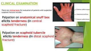 scaphoid fracture physical therapy presentation.pptx