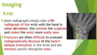 scaphoid fracture physical therapy presentation.pptx