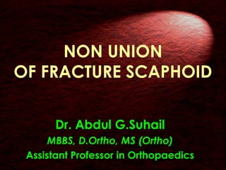Scaphoid fractures | PPT
