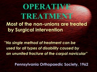 Scaphoid fractures | PPT