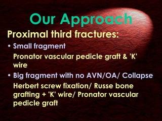 Scaphoid fractures | PPT
