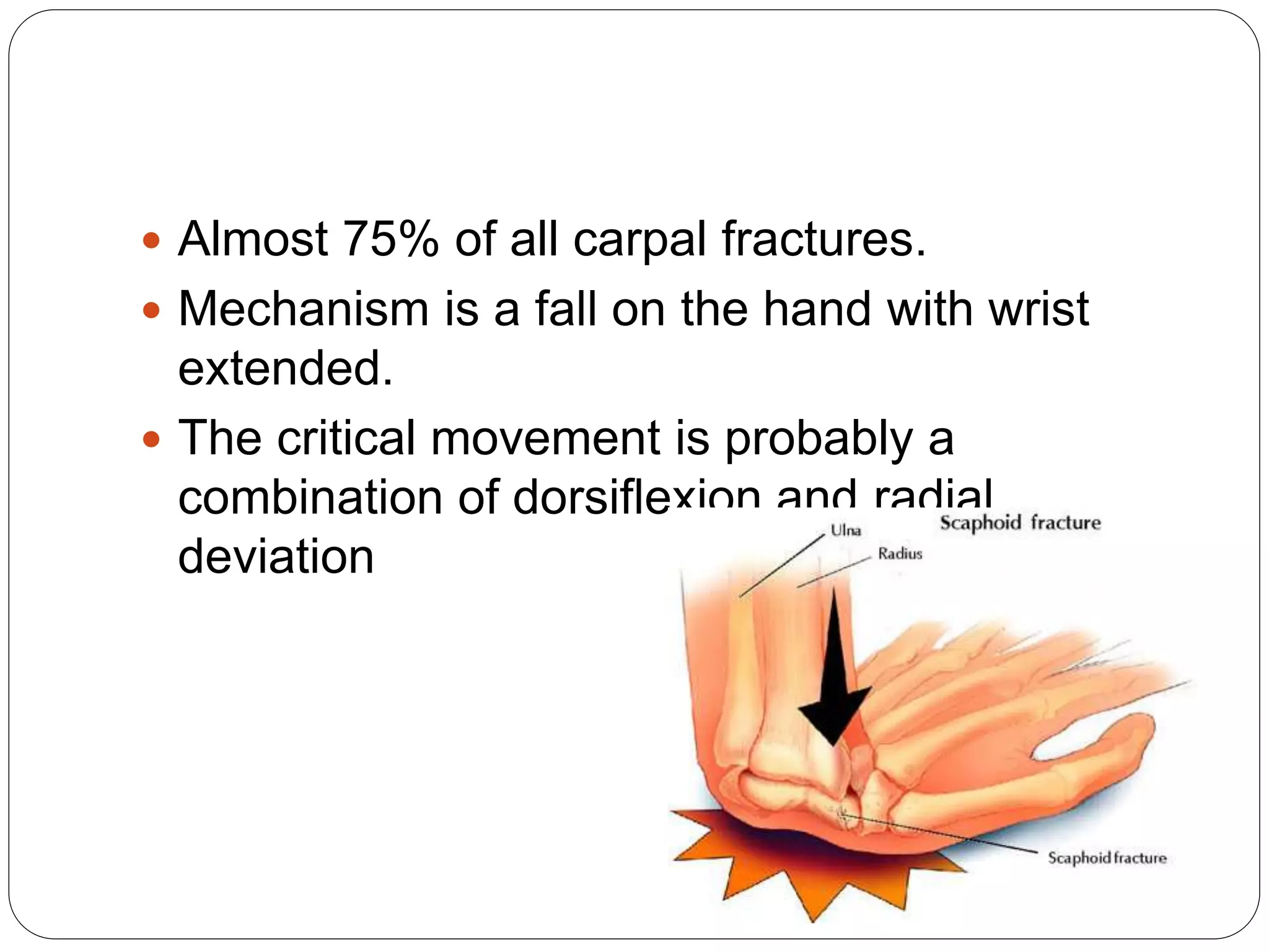 Scaphoid fractures | PPTX | Death, Injury, or Military Conflict ...