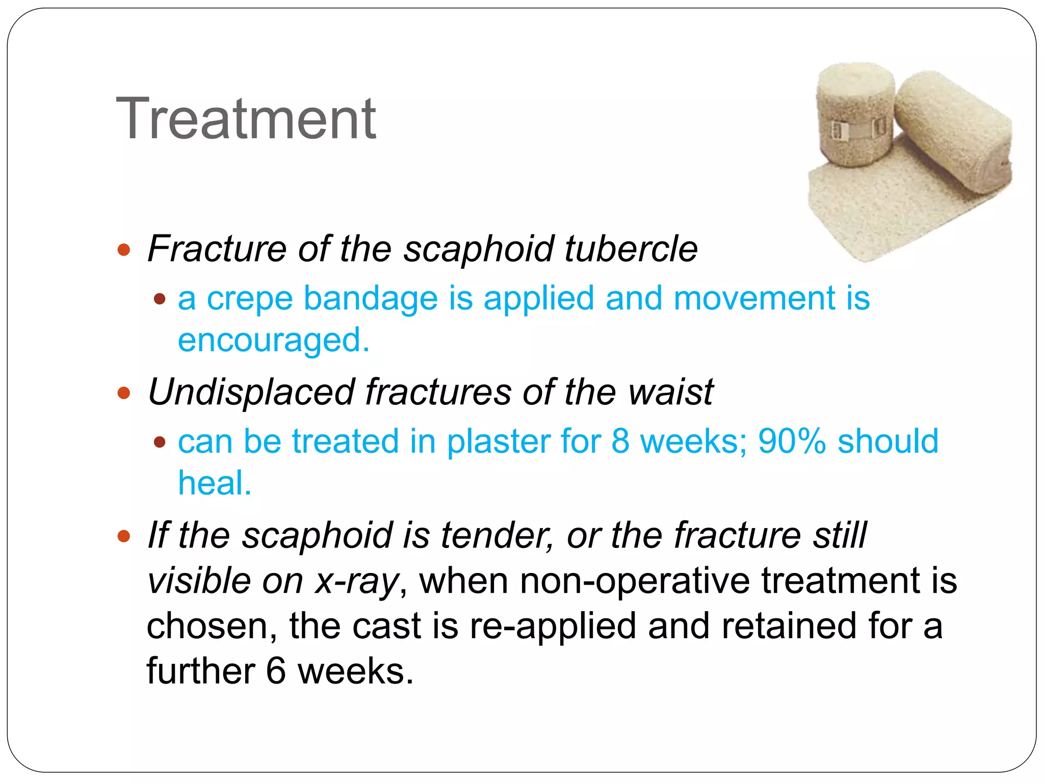Scaphoid fractures | PPTX | Death, Injury, or Military Conflict ...