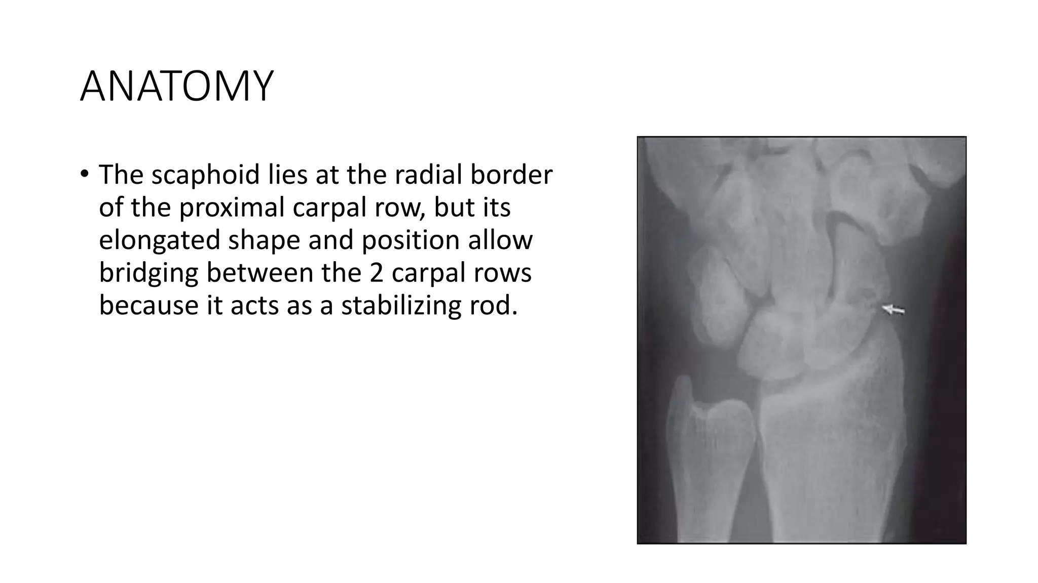 Scaphoid fractures | PPTX
