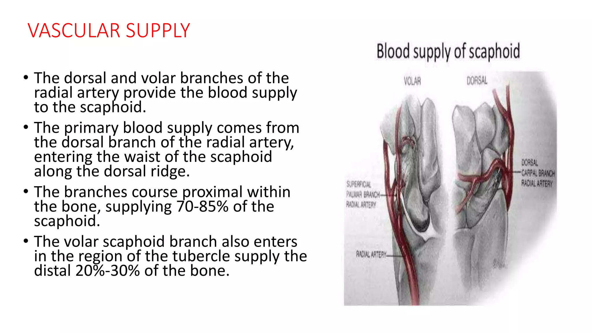 Scaphoid fractures | PPTX