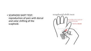 Scaphoid fractures | PPT