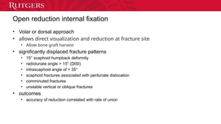 Scaphoid Fractures: Indications and Techniques | PPT