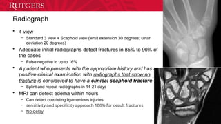 Scaphoid Fractures: Indications and Techniques | PPT