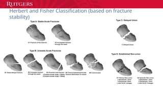 Scaphoid Fractures: Indications and Techniques | PPT