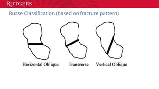 Scaphoid Fractures: Indications and Techniques | PPT
