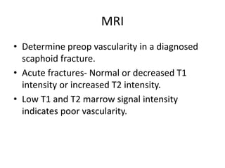 Scaphoid fractures and non union | PPTX