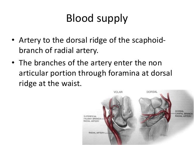 Scaphoid fractures and non union