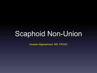 Scaphoid non union- by Hussain Algawahmed | PPTX