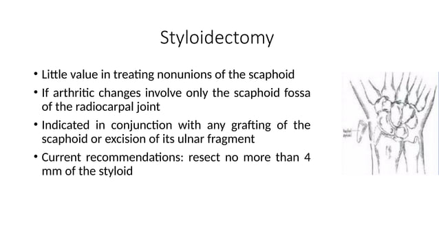 SCAPHOID NON UNION AND SNAC by Dr Binod | PPT