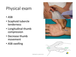 Scaphoid fracture | PPT