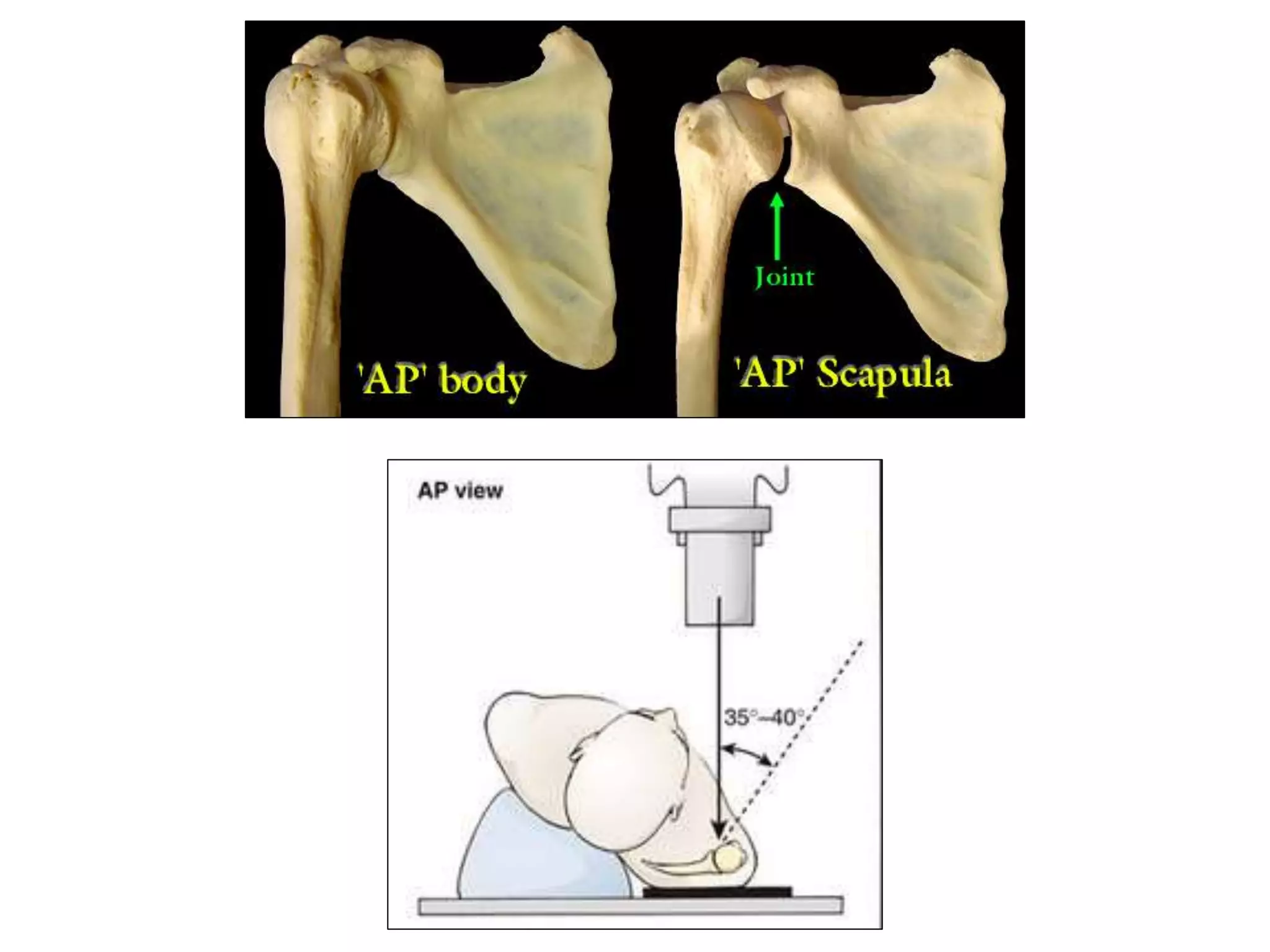 Scapula antomy.pptx