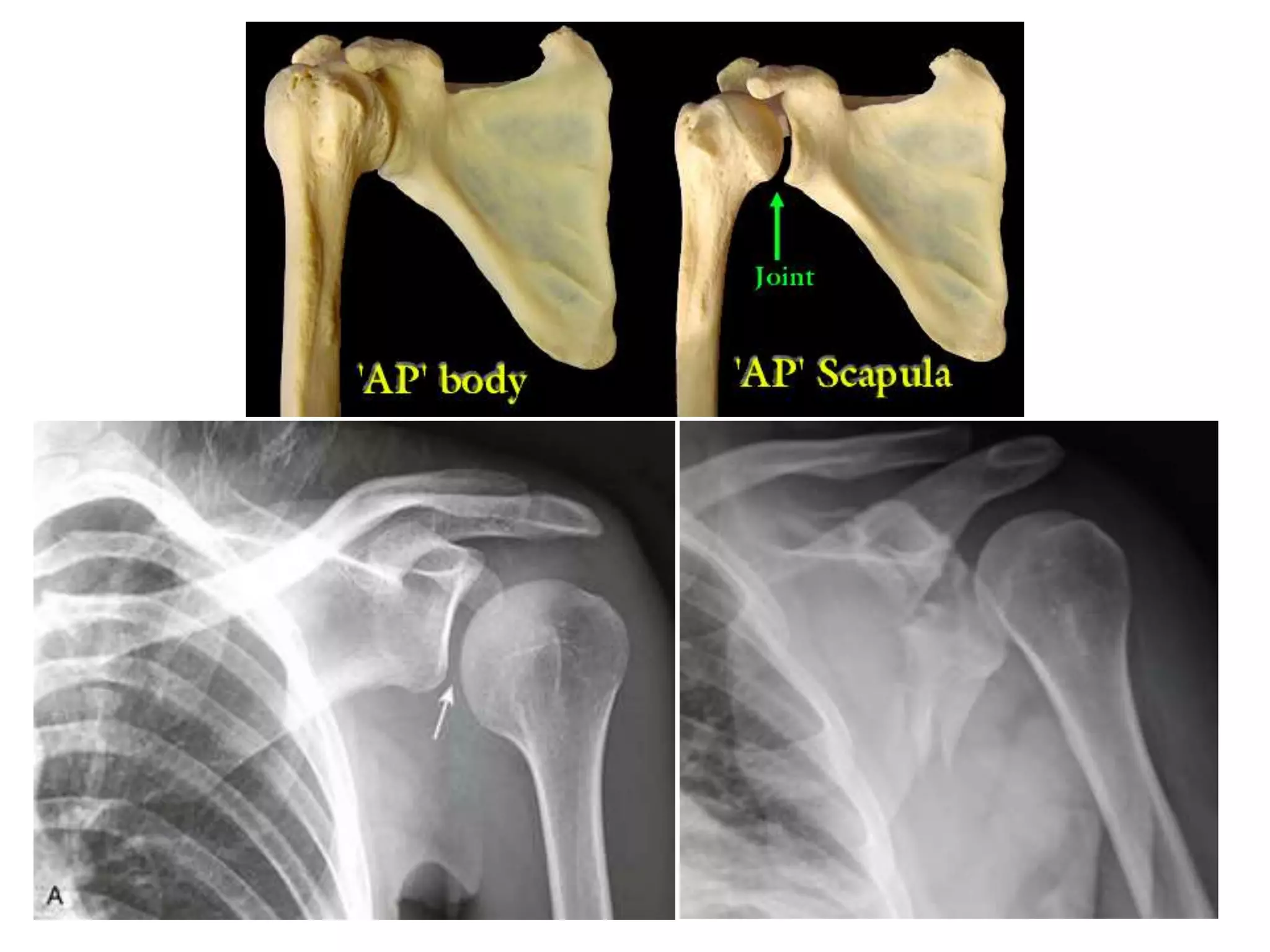 Scapula antomy.pptx