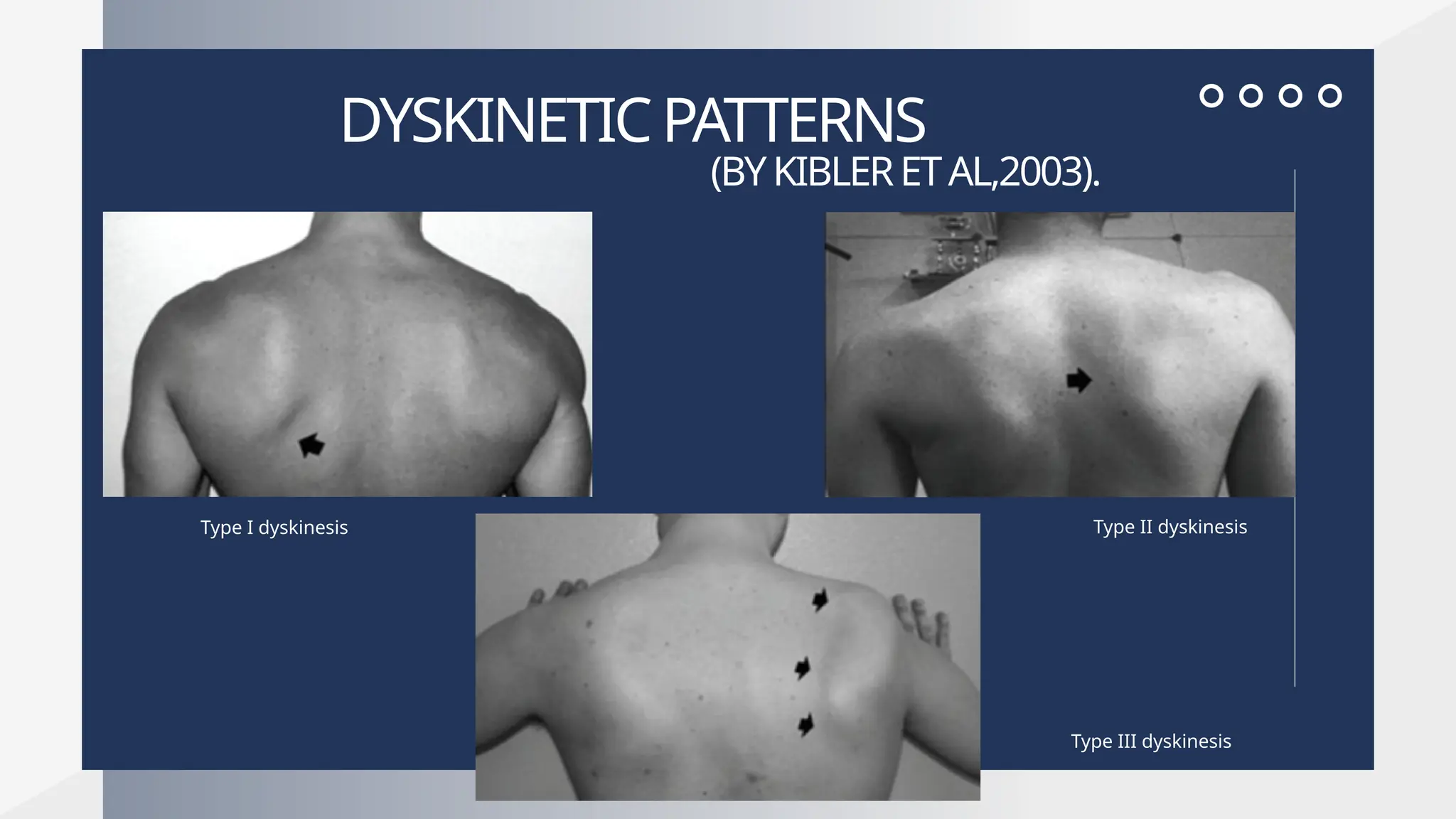 Is scapular dyskinesis a real condition or a functional adaptation? | PPTX