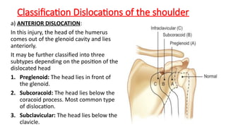 scapula fracture along with treatment .pptx