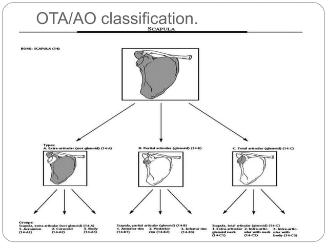 Scapula fracture diagnosis and management | PPTX