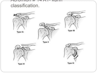 Scapula fracture diagnosis and management | PPTX
