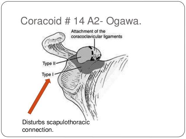 Scapula fracture diagnosis and management