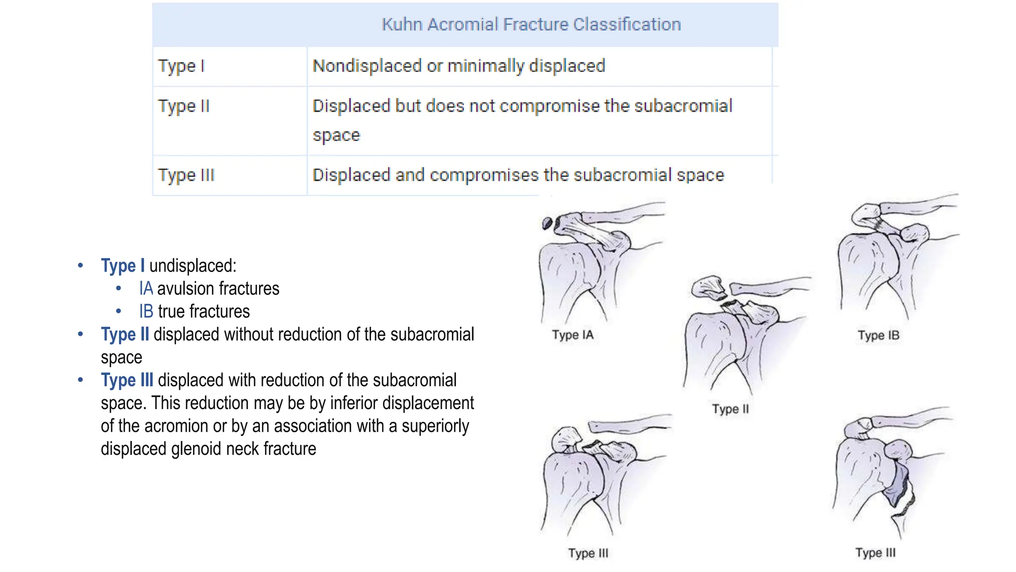 A review of Scapula Fractures with it's managment.pptx