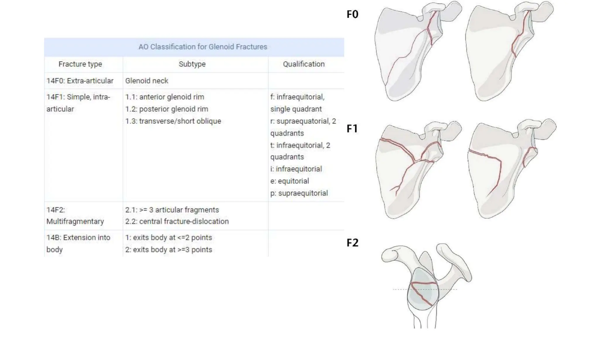 A review of Scapula Fractures with it's managment.pptx